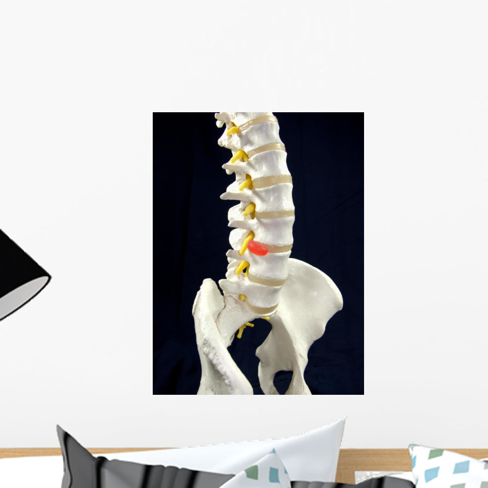 Spinal Disc Anatomy Wall Mural – Wallmonkeys