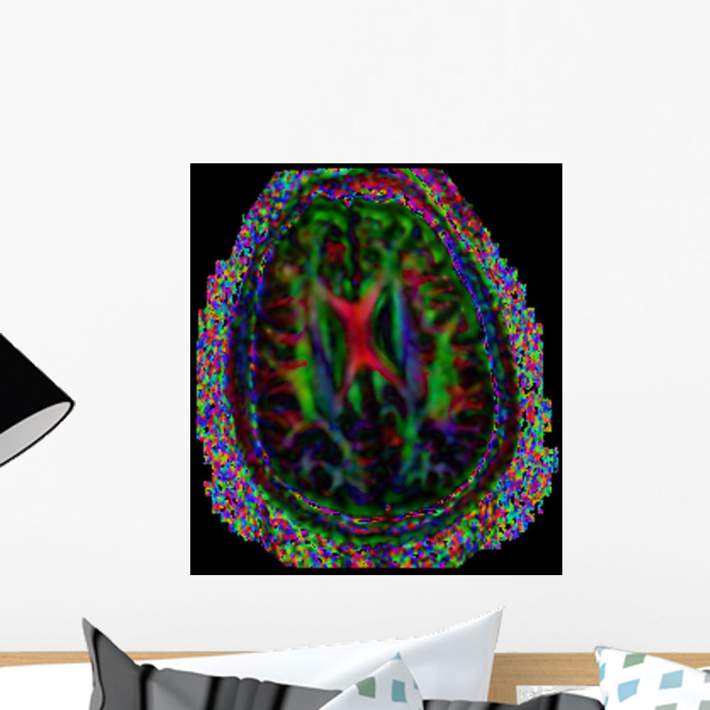 Brain Mri Wall Mural – Wallmonkeys