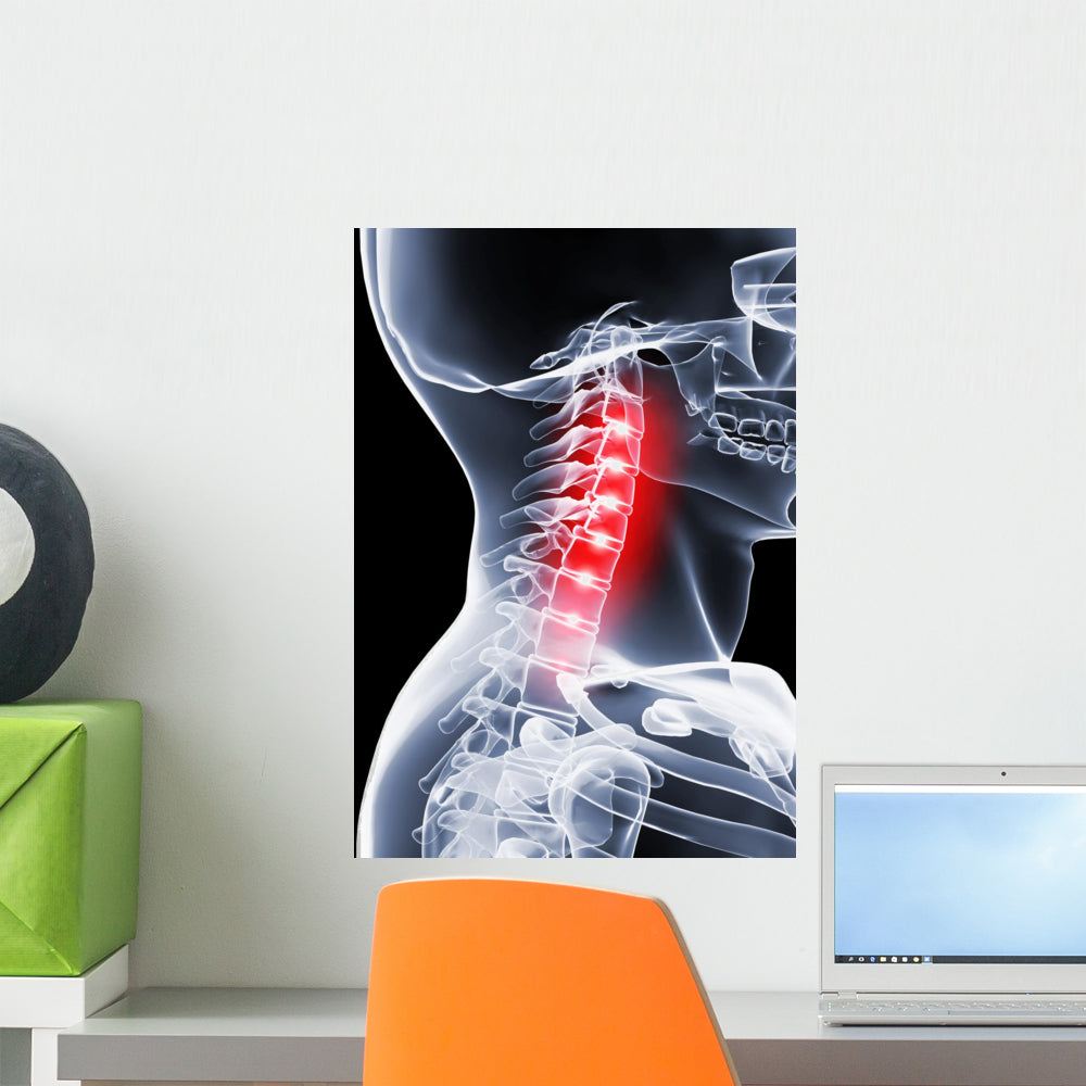 Spinal Backstroke Wall Mural – Wallmonkeys