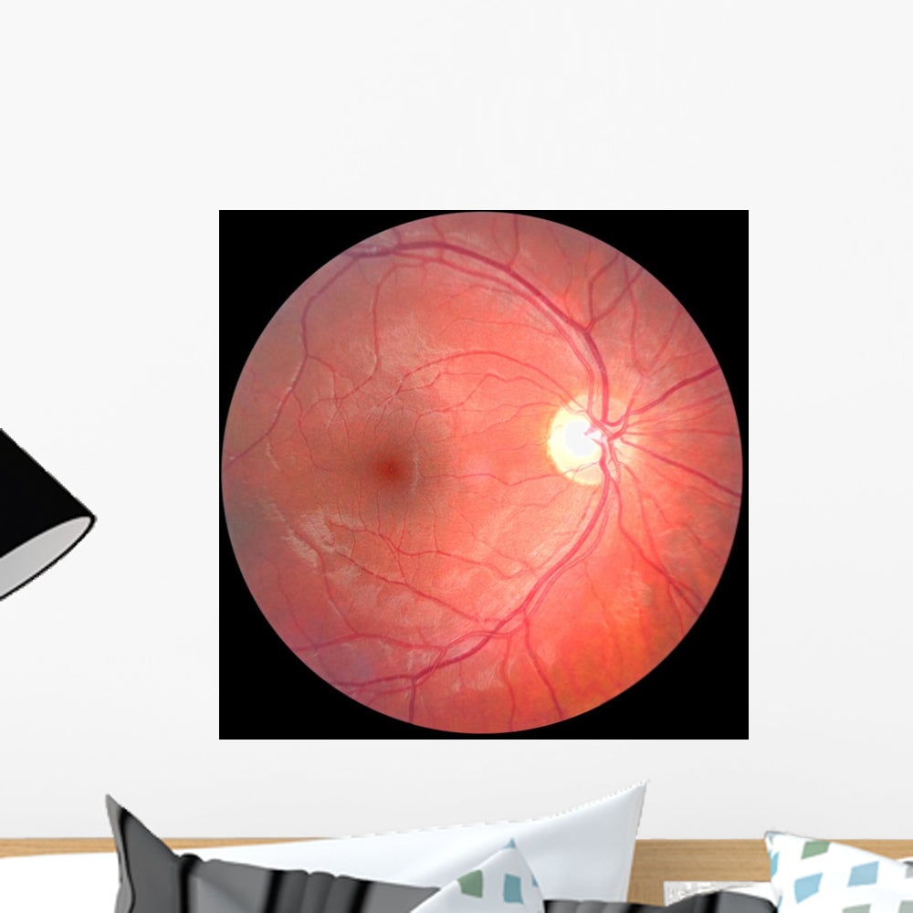 Retina Wall Mural – Wallmonkeys