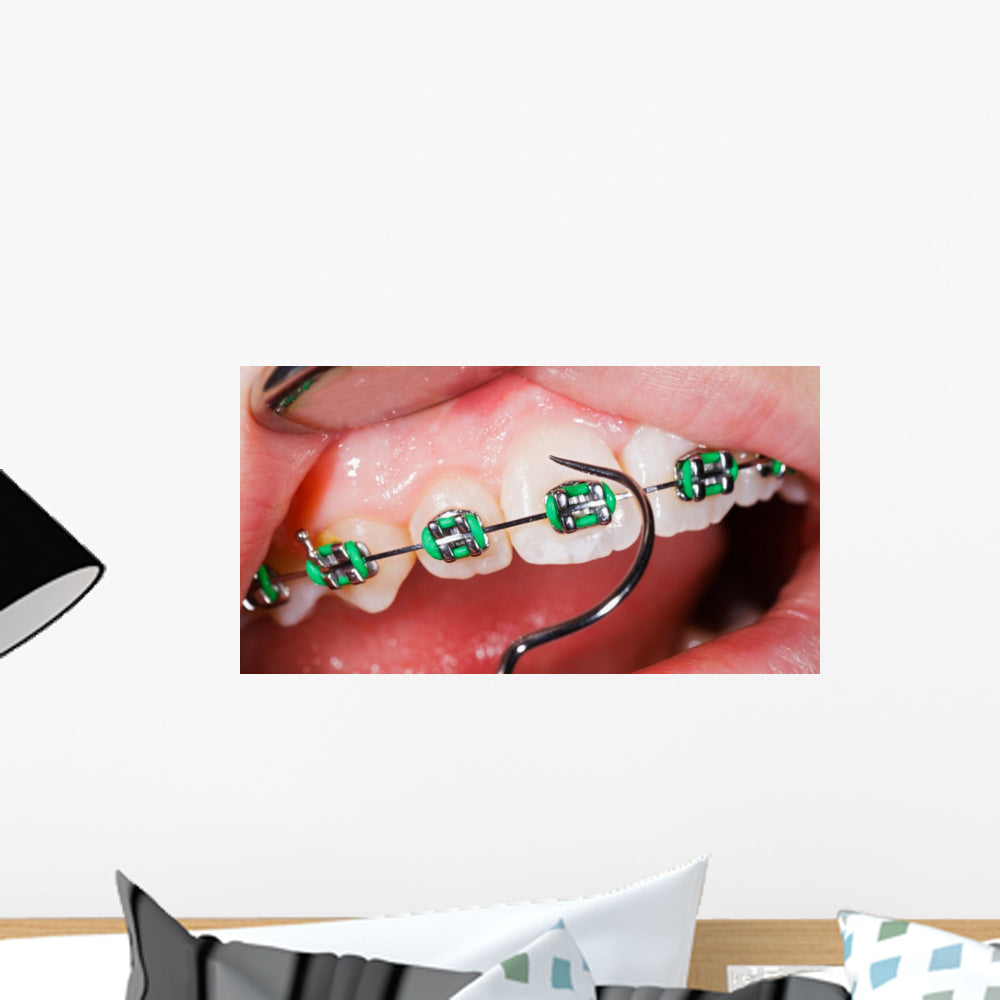 Teeth With Braces Wall Decal - WallMonkeys.com – Wallmonkeys