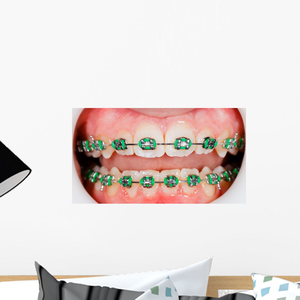 Braces On Teeth Wall Decal - WallMonkeys.com – Wallmonkeys