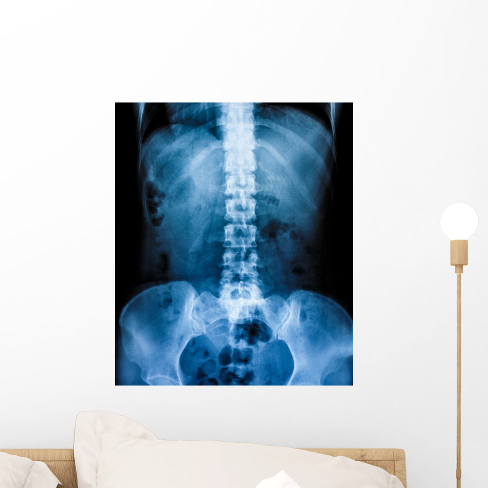 X-Ray Scan Human Wall Decal - WallMonkeys.com – Wallmonkeys