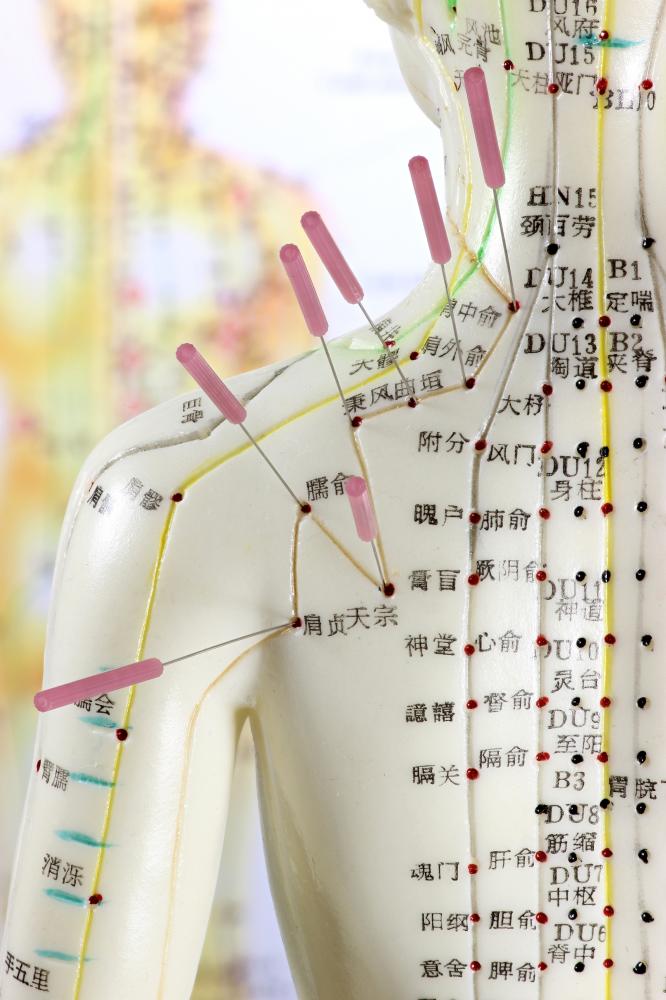 Acupuncture Model Wall Decal - WallMonkeys.com – Wallmonkeys